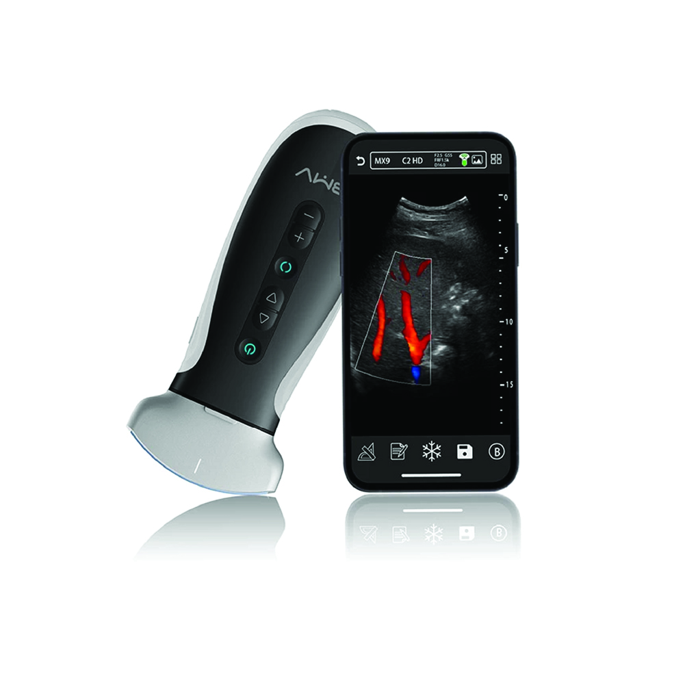 Ultrassom portátil – Egumy